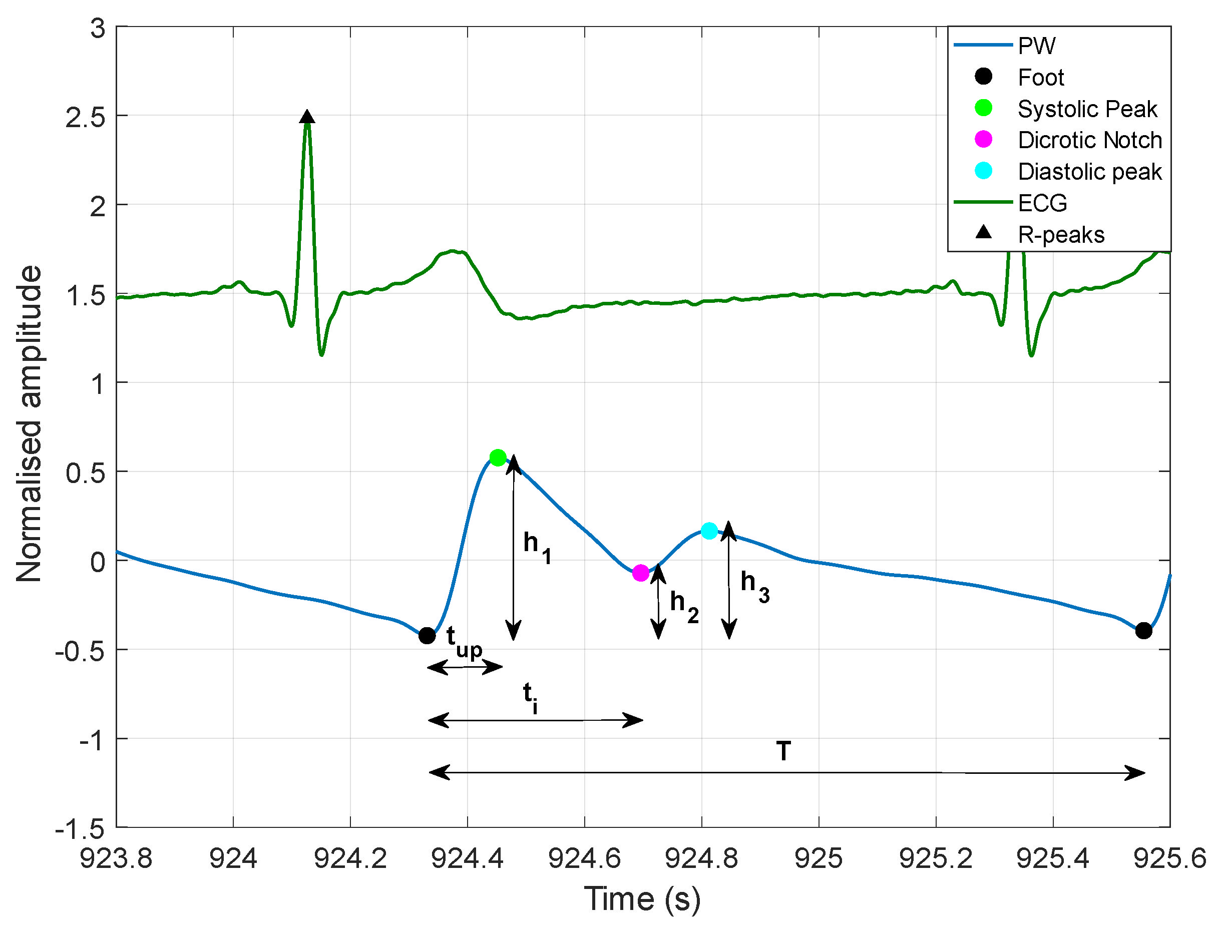 Multimodal Finger Pulse Wave Sensing: Comparison of Forcecardiography and Photoplethysmography ...