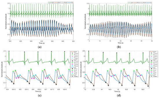 Multimodal Finger Pulse Wave Sensing: Comparison of Forcecardiography ...