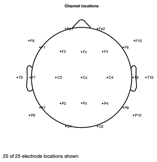 Classification of EEG Using Adaptive SVM Classifier with CSP and Online Recursive Independent ...