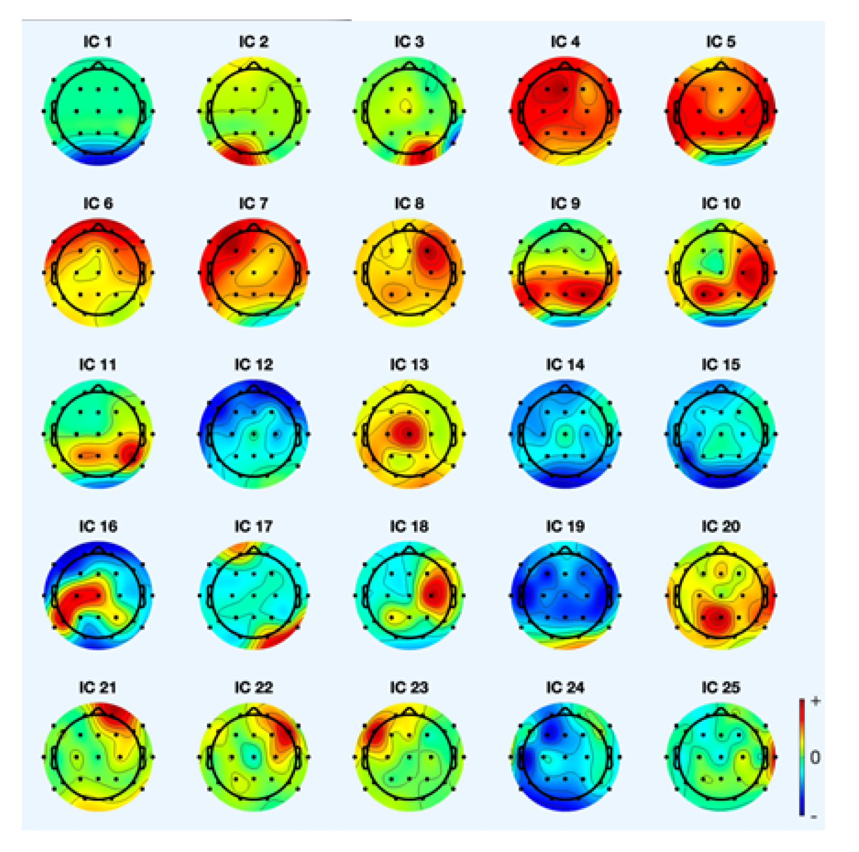 Classification of EEG Using Adaptive SVM Classifier with CSP and Online Recursive Independent ...