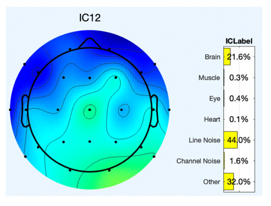 Classification of EEG Using Adaptive SVM Classifier with CSP and Online Recursive Independent ...