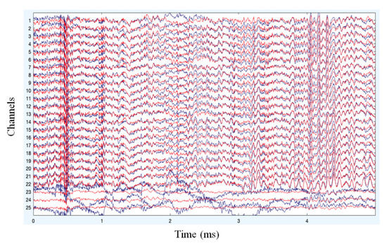 Classification of EEG Using Adaptive SVM Classifier with CSP and Online Recursive Independent ...