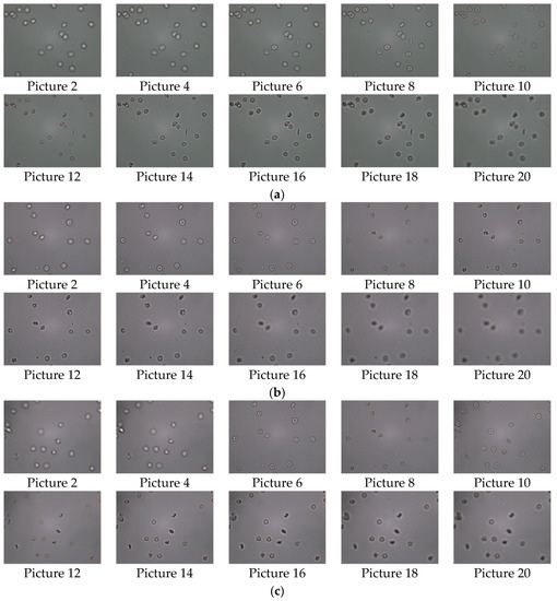 A Method for Medical Microscopic Images’ Sharpness Evaluation Based on NSST and Variance by ...
