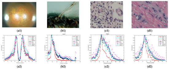 A Method for Medical Microscopic Images’ Sharpness Evaluation Based on NSST and Variance by ...