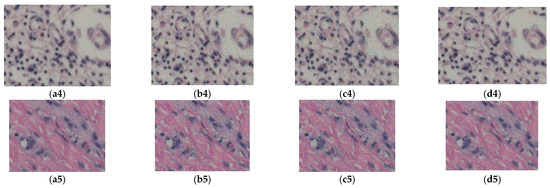 A Method for Medical Microscopic Images’ Sharpness Evaluation Based on NSST and Variance by ...