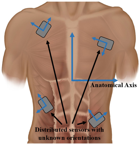Trunk Posture from Randomly Oriented Accelerometers