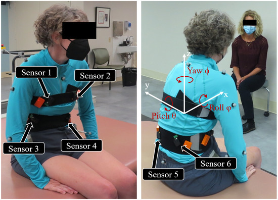 Trunk Posture from Randomly Oriented Accelerometers