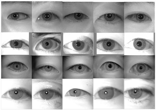 Iris Recognition Method Based on Parallel Iris Localization Algorithm ...