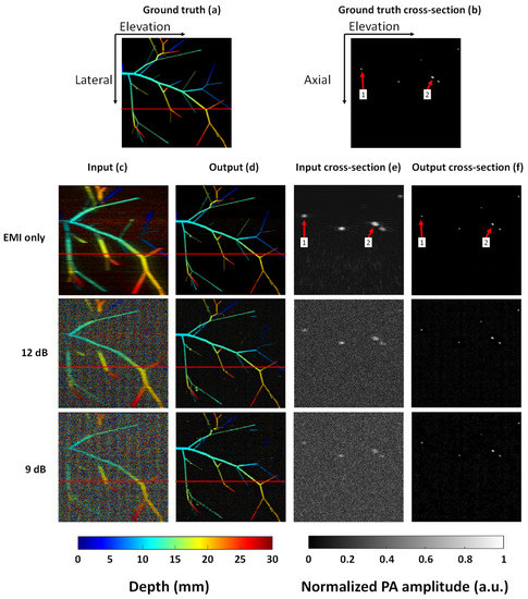 Deep-E Enhanced Photoacoustic Tomography Using Three-Dimensional ...