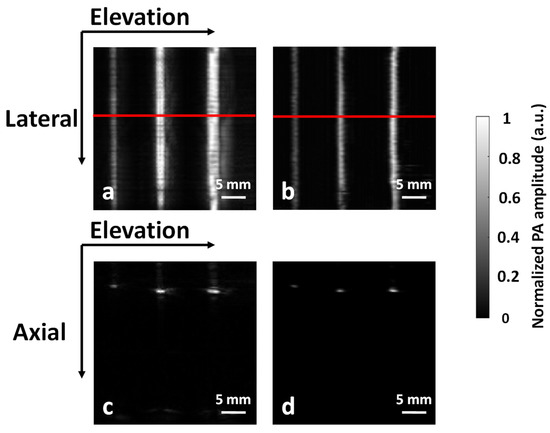 Deep-E Enhanced Photoacoustic Tomography Using Three-Dimensional ...