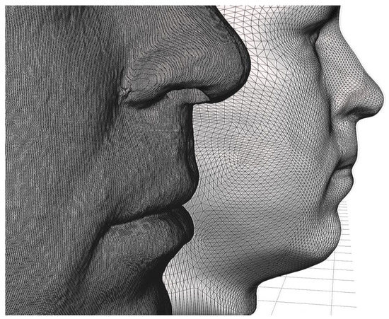 Smartphone-Based Facial Scanning as a Viable Tool for Facially Driven ...