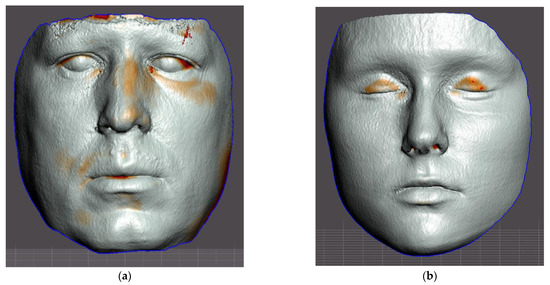 Smartphone-Based Facial Scanning as a Viable Tool for Facially Driven ...