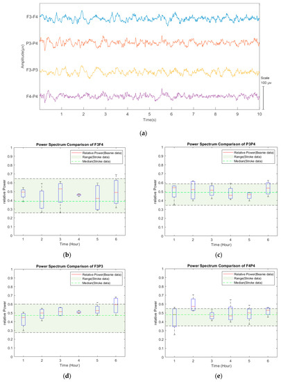 Developing Disposable EEG Cap for Infant Recordings at the Neonatal ...