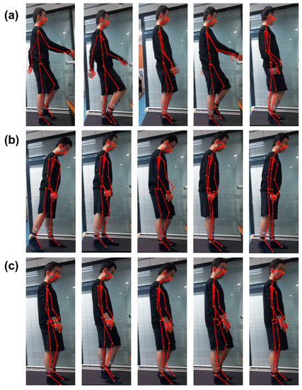 Computer Vision and Machine Learning-Based Gait Pattern Recognition for Flat Fall Prediction