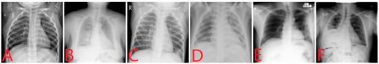 Classification and Detection of COVID-19 and Other Chest-Related ...