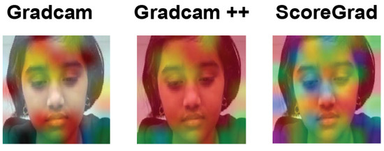 Sensors | Free Full-Text | Kids’ Emotion Recognition Using Various Deep ...