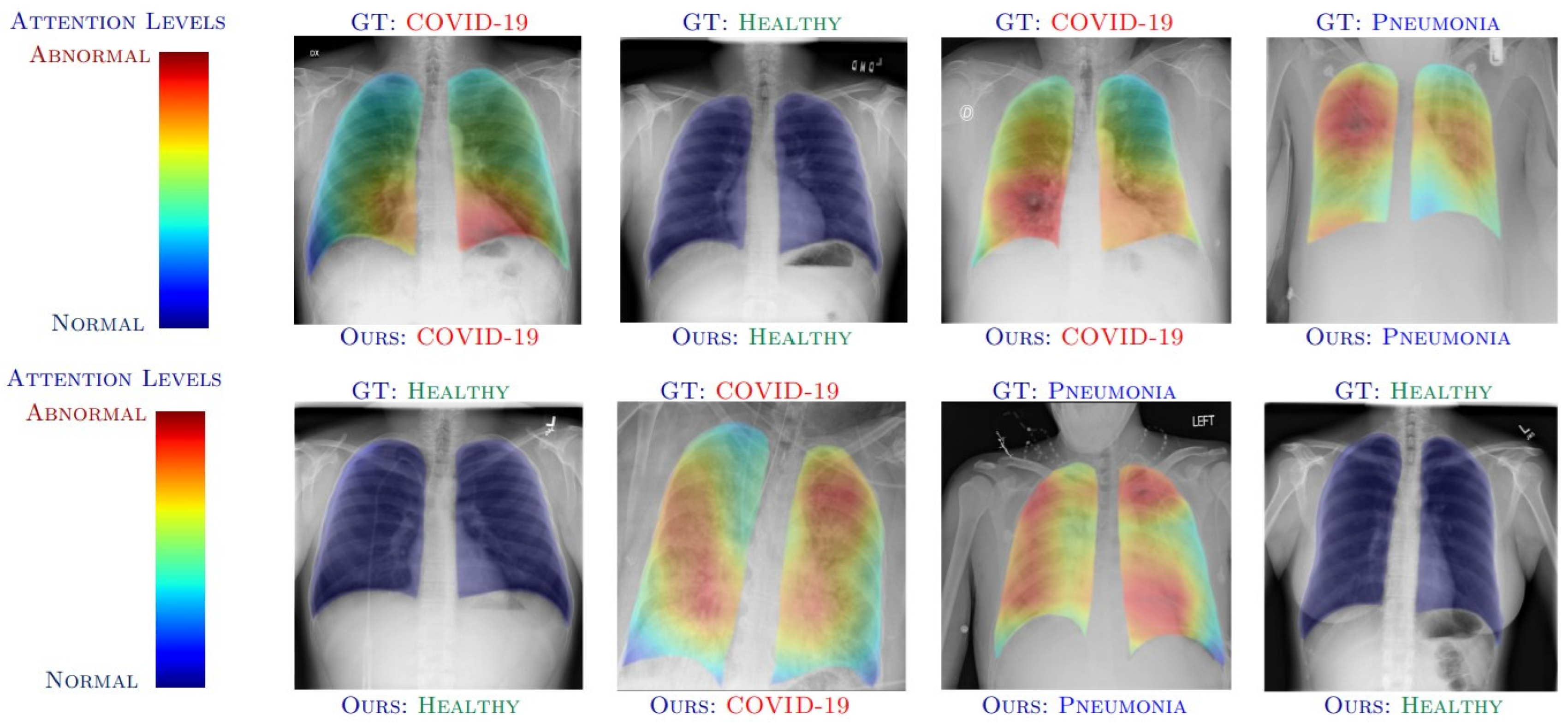Sensors | Free Full-Text | A Survey on Medical Explainable AI (XAI ...