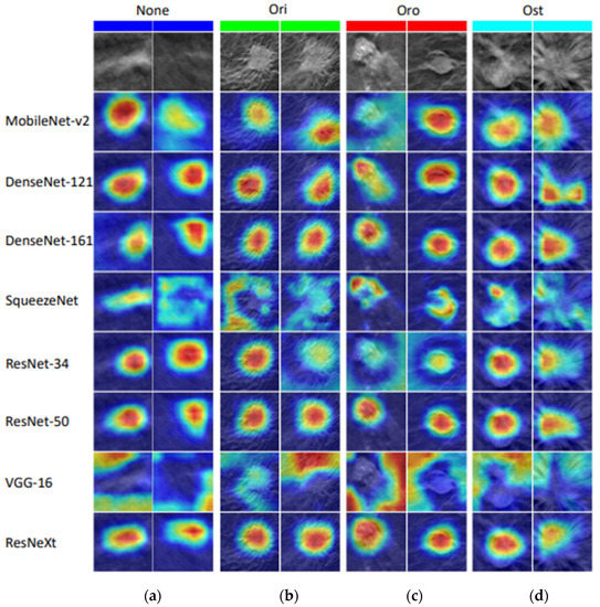 A Survey on Medical Explainable AI (XAI): Recent Progress ...