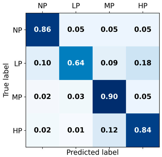 Personalized Deep Bi-LSTM RNN Based Model for Pain Intensity Classification Using EDA Signal