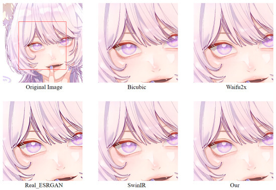 A Transformer-Based Model for Super-Resolution of Anime Image