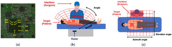 Non-Contact VITAL Signs Monitoring of a Patient Lying on Surgical Bed ...