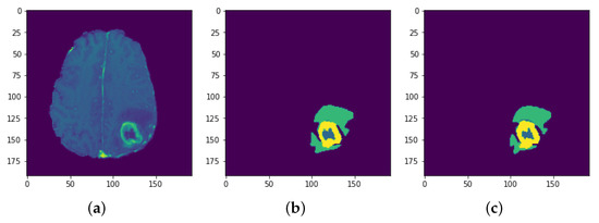 Deep Learning Hybrid Techniques for Brain Tumor Segmentation