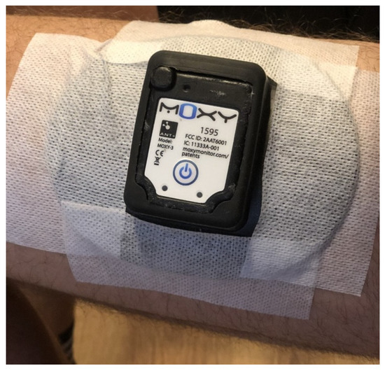 Sensors | Free Full-Text | Muscle Oxygenation Measured with Near ...