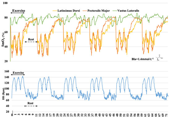 Sensors | Free Full-Text | Muscle Oxygenation Measured with Near ...