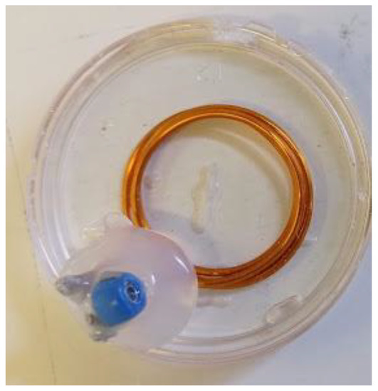 An Ex Vivo Study of Wireless Linkage Distance between Implantable LC ...