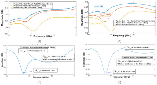 An Ex Vivo Study of Wireless Linkage Distance between Implantable LC ...