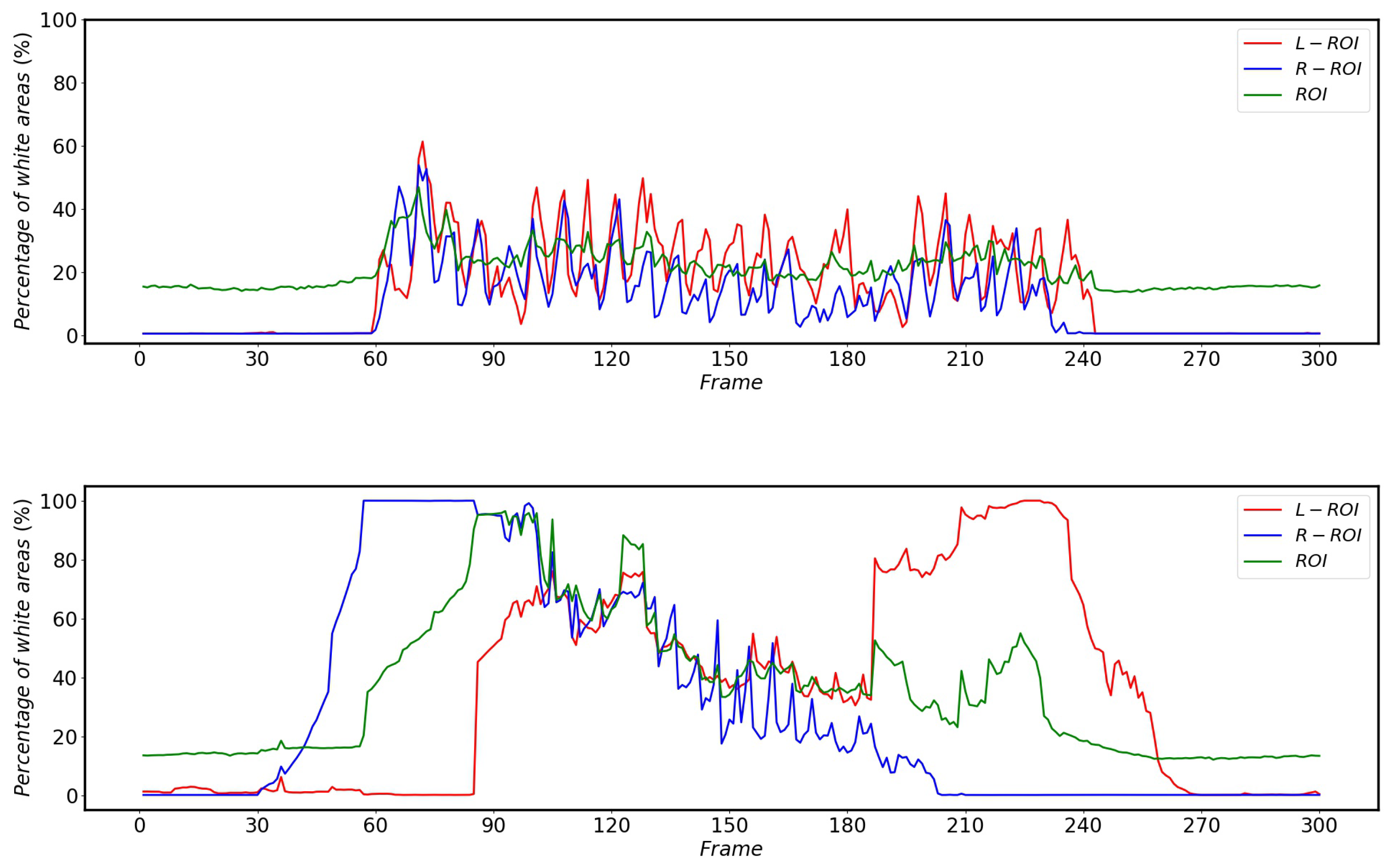 Pantograph Detection Algorithm with Complex Background and External Disturbances