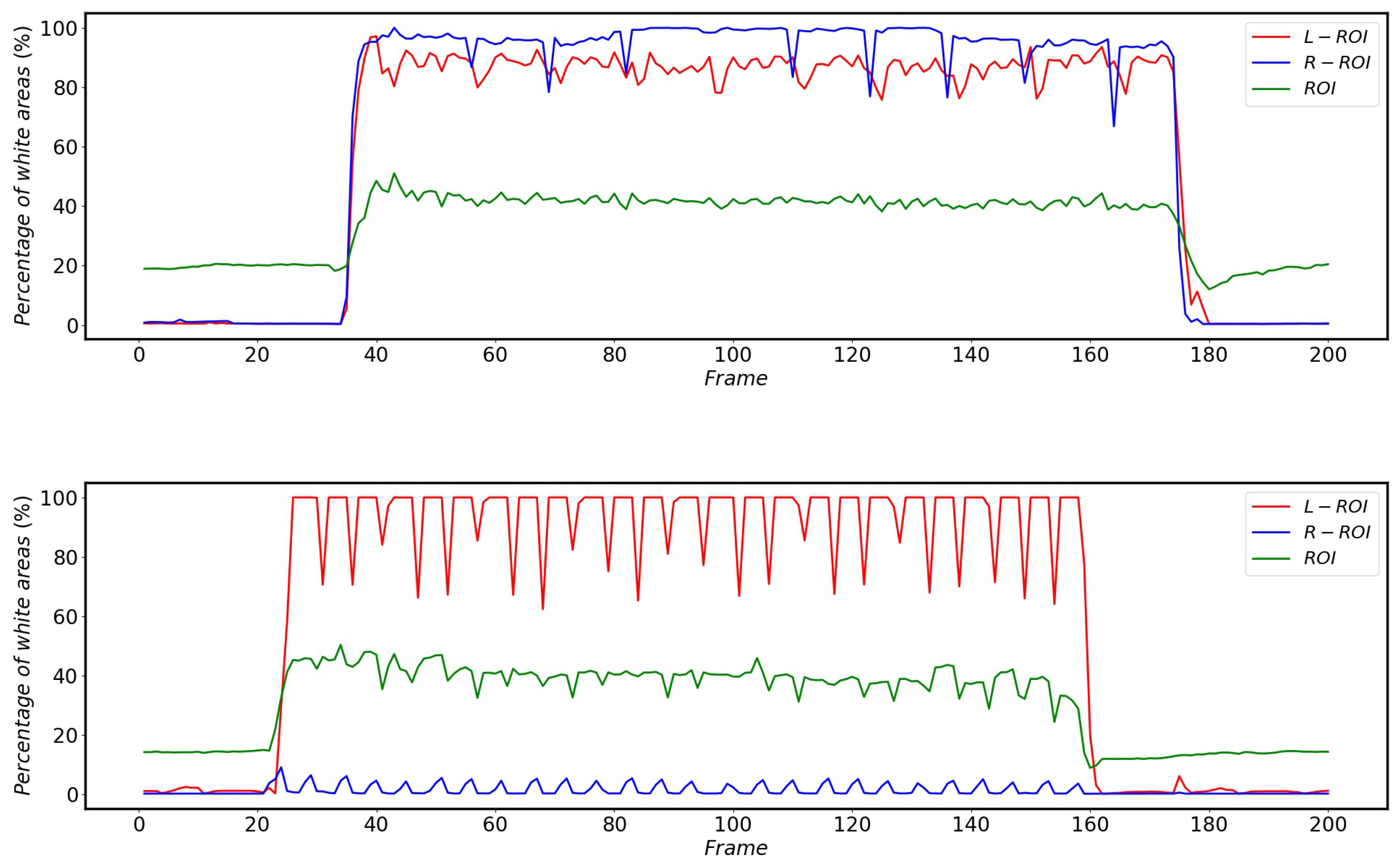 Pantograph Detection Algorithm with Complex Background and External Disturbances