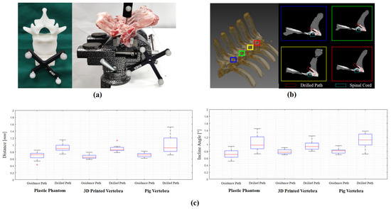 Sensors | Free Full-Text | A Novel Point Set Registration-Based Hand ...