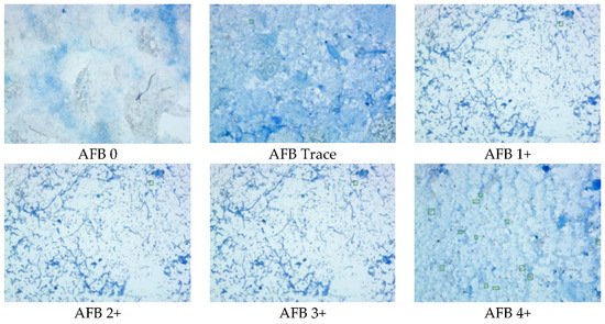 Evaluation of an AI-Based TB AFB Smear Screening System for Laboratory ...