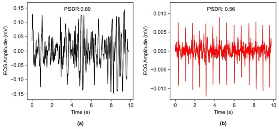 Dependence of Skin-Electrode Contact Impedance on Material and Skin ...