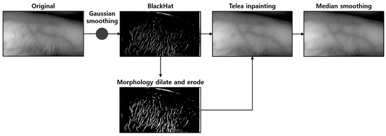 Design and Implementation of Embedded-Based Vein Image Processing System with Enhanced Denoising ...
