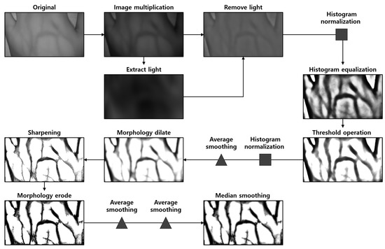 Design and Implementation of Embedded-Based Vein Image Processing System with Enhanced Denoising ...