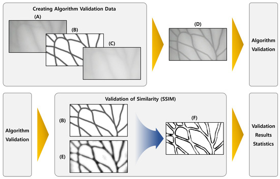 Design and Implementation of Embedded-Based Vein Image Processing System with Enhanced Denoising ...