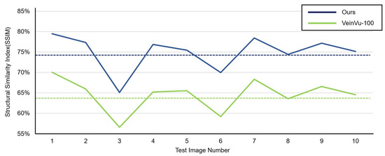 Design and Implementation of Embedded-Based Vein Image Processing System with Enhanced Denoising ...