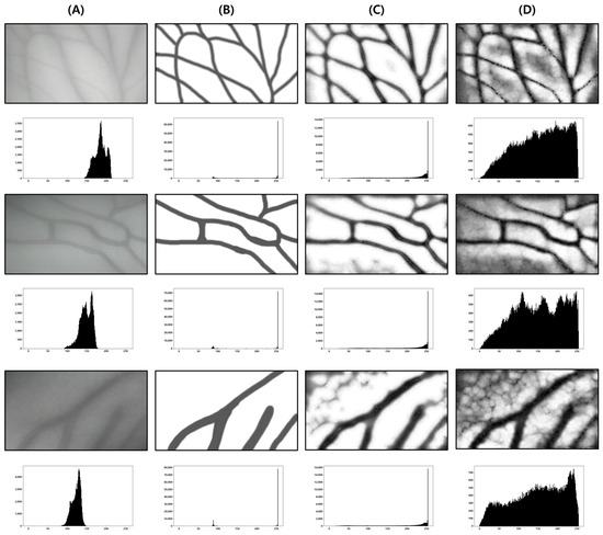 Design and Implementation of Embedded-Based Vein Image Processing System with Enhanced Denoising ...