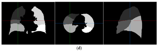 A Fissure-Aided Registration Approach for Automatic Pulmonary Lobe Segmentation Using Deep Learning