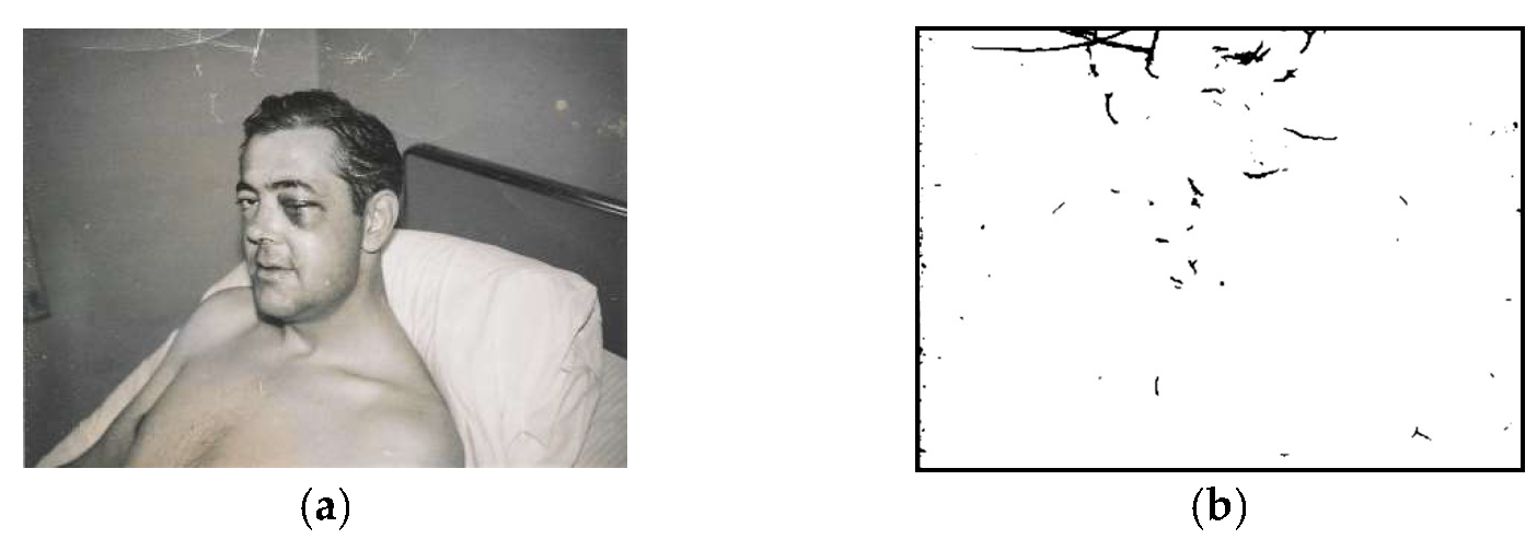 Learning-Based Image Damage Area Detection for Old Photo Recovery