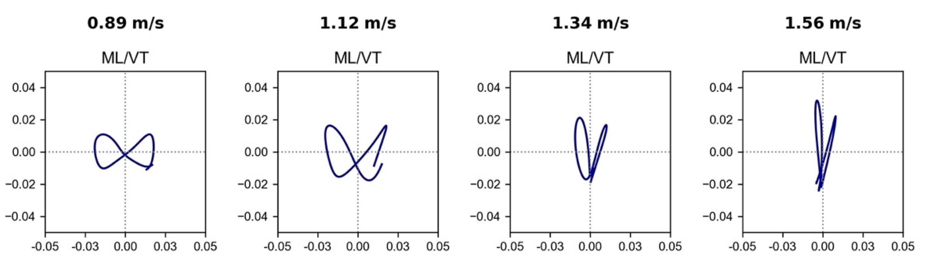 Sensors | Free Full-Text | A New Quantitative Gait Analysis Method ...