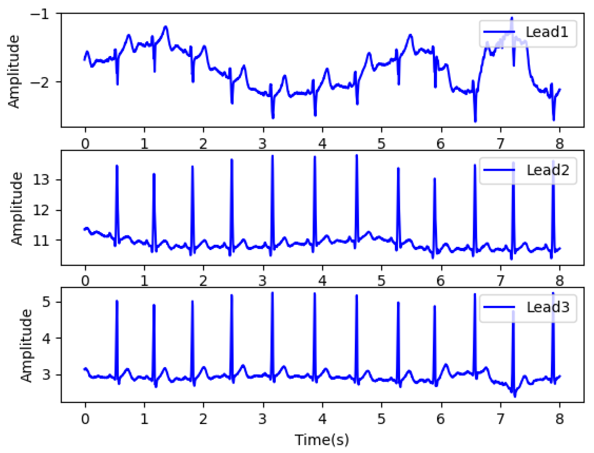 Gated Recurrent Unit Network for Psychological Stress Classification ...