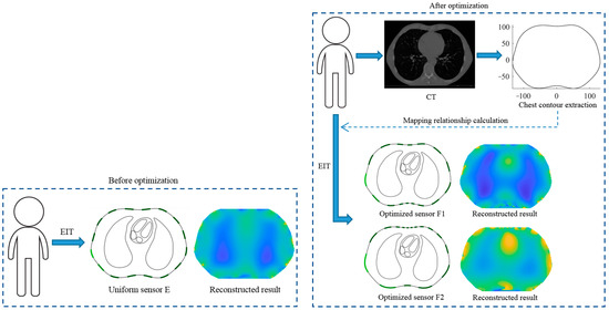 Case-Specific Focal Sensor Design for Cardiac Electrical Impedance ...