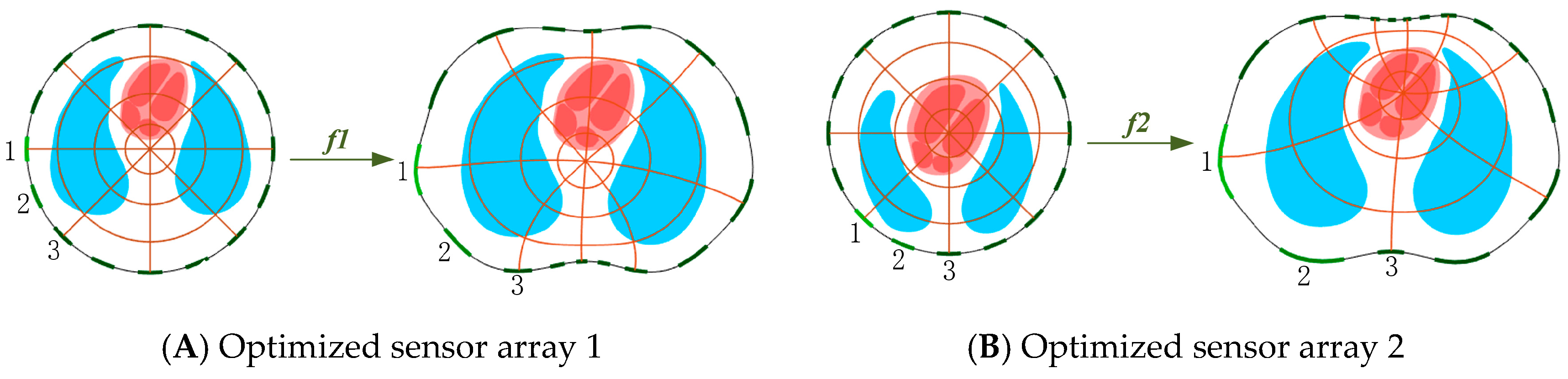Sensors | Free Full-Text | Case-Specific Focal Sensor Design for Cardiac Electrical Impedance ...