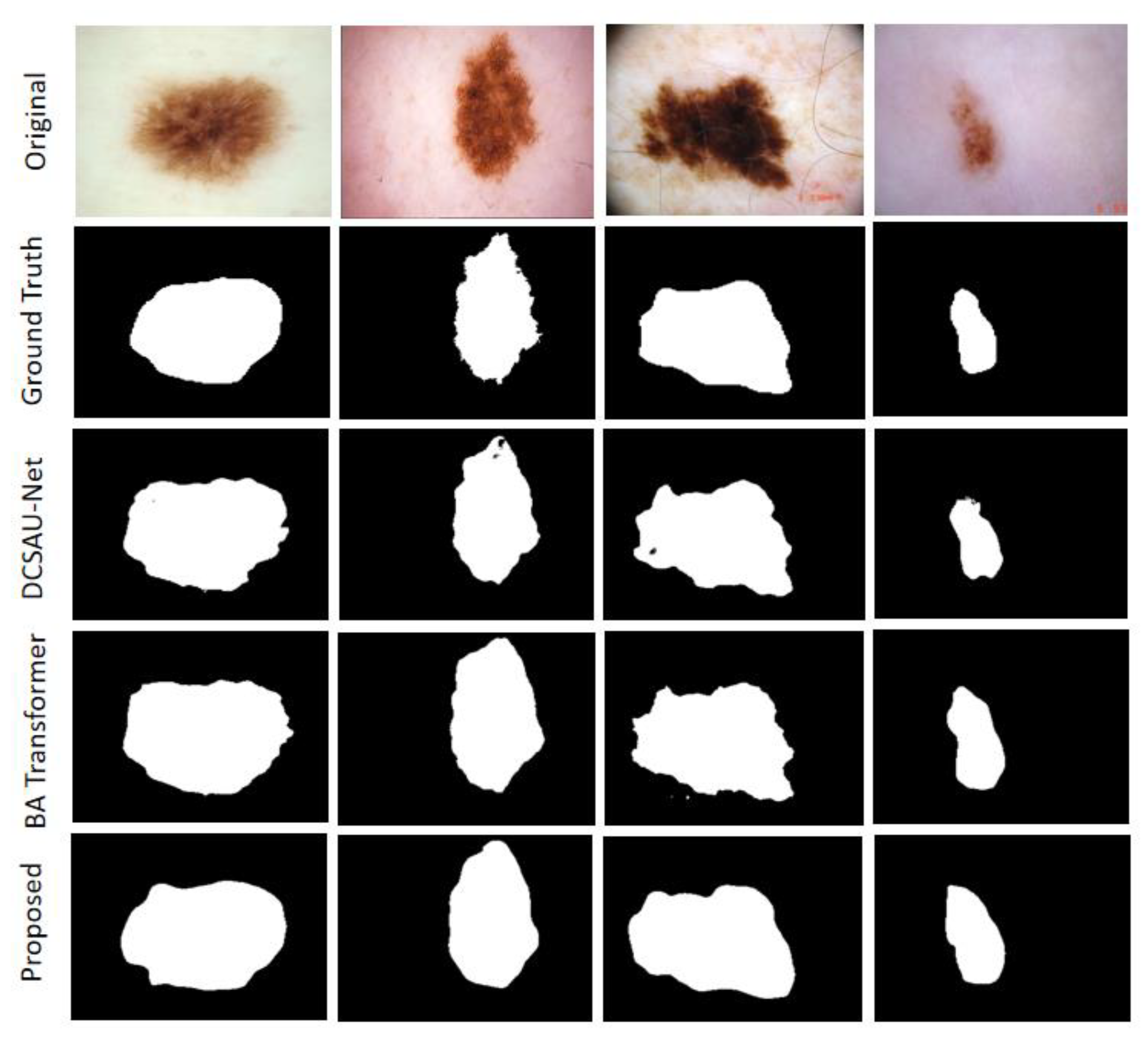 Sensors | Free Full-Text | MHAU-Net: Skin Lesion Segmentation Based on Multi-Scale Hybrid ...