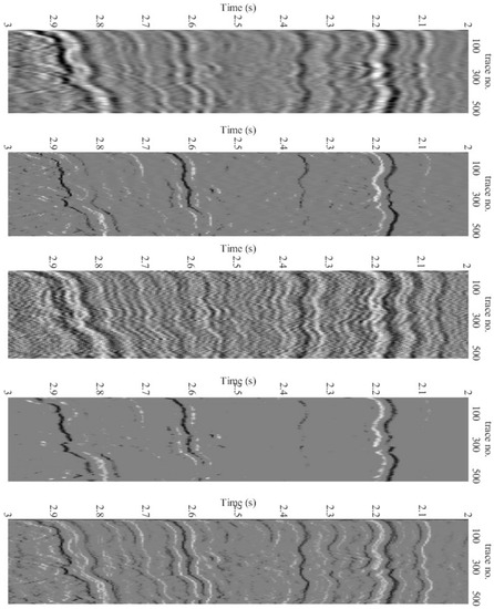 Sensors | Free Full-Text | Signal Recovery from Randomly Quantized Data Using Neural Network ...