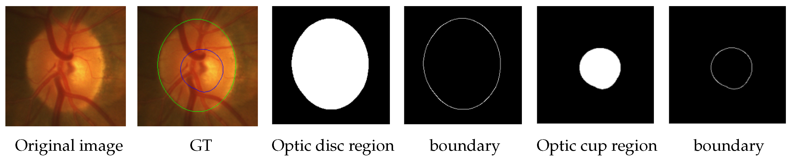 Sensors | Free Full-Text | Unsupervised Domain Adaptation with Shape Constraint and Triple ...