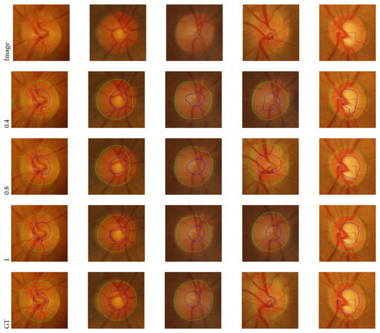 Sensors | Free Full-Text | Unsupervised Domain Adaptation with Shape Constraint and Triple ...